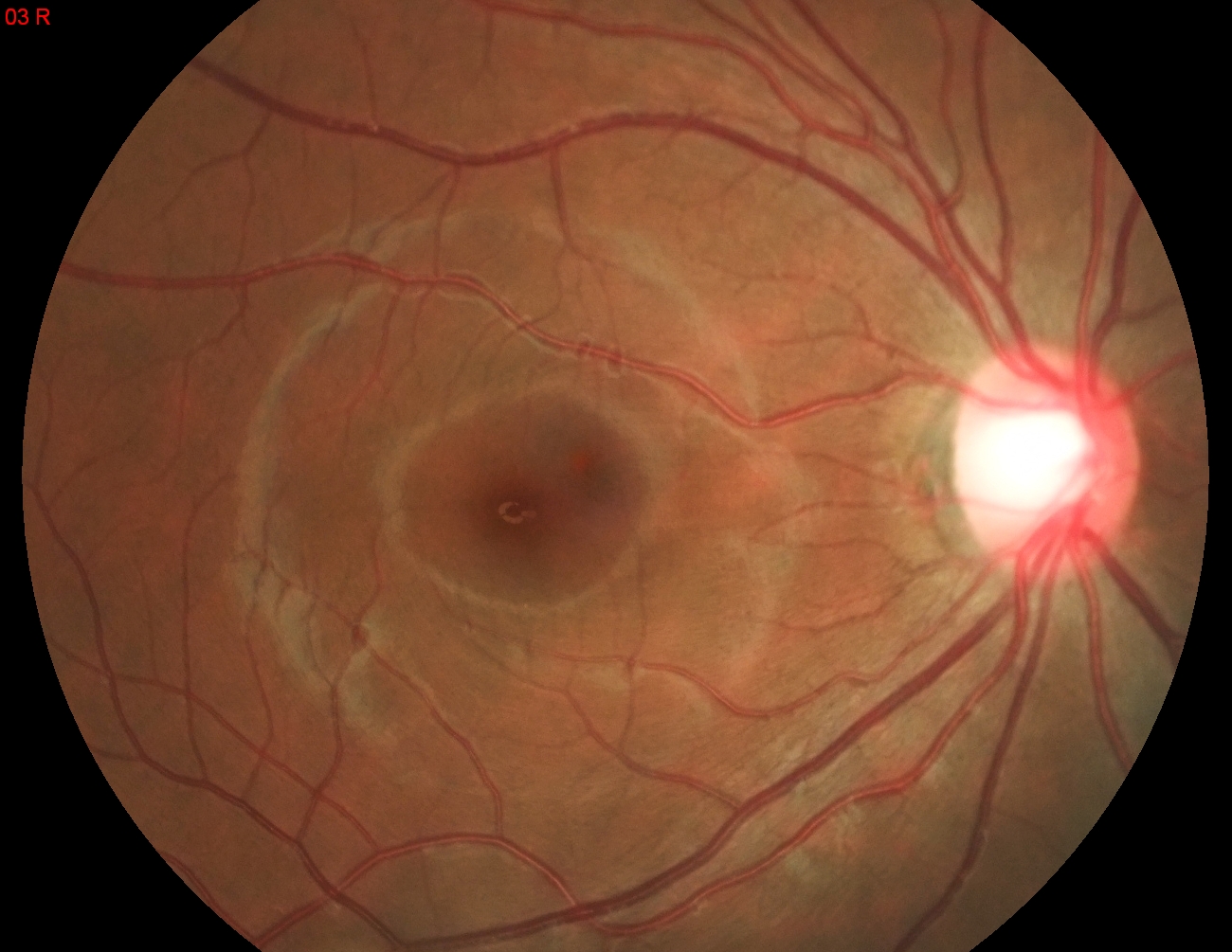 BEIJING SUNSHINE OPTICAL COMPANY LTD.