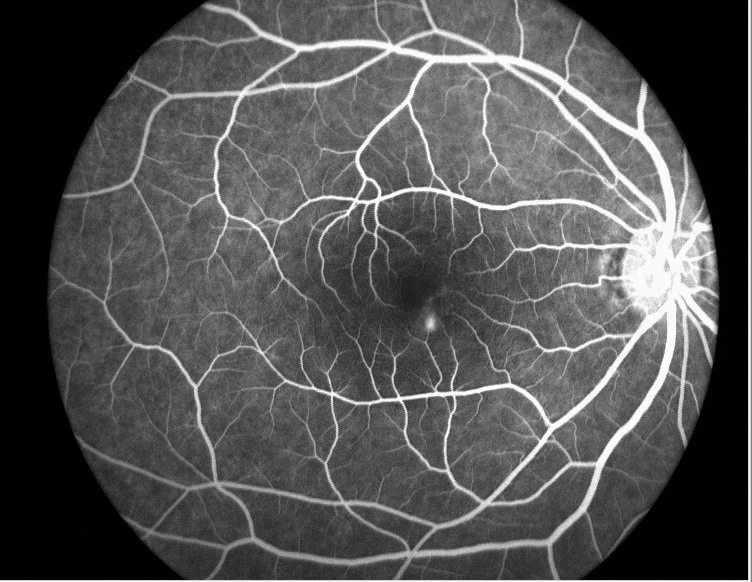 BEIJING SUNSHINE OPTICAL COMPANY LTD.